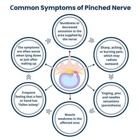 Pinched Nerve Doctor Nyc And Nj Pinched Nerve Specialists In New York
