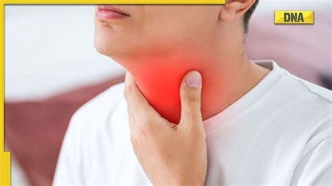 Sore Throat Remedies