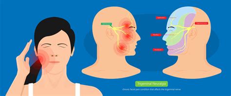 Trigeminal Nerve Examination