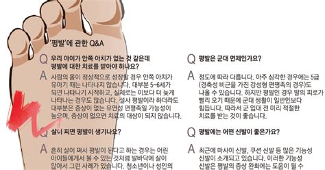 발 안쪽 아치 사라졌나요 굽 없는 신발 신지 마세요
