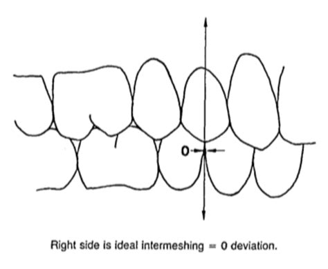 Extraction Calculator — Ortho Calculator