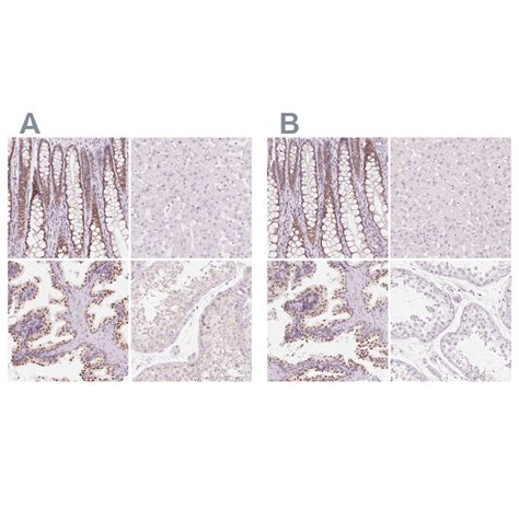 Rabbit Polyclonal Anti Hoxb13 Antibody Buy For Research Highly Specific Rigorously