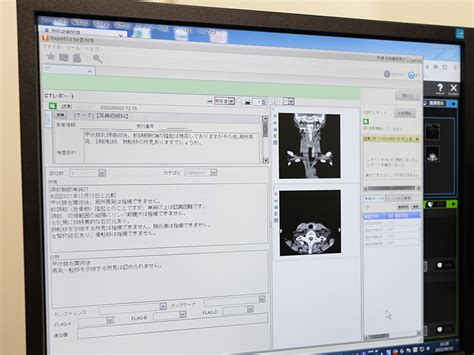 遠隔画像診断サービス 遠隔画像診断遠隔読影サービスならEIISへExpert Imaging and Interventional