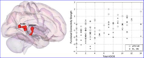 Table 1 From Integration And Segregation Of Default Mode Network Resting State Functional