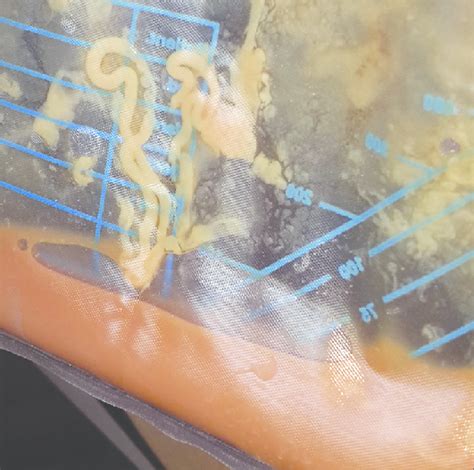 Coiled Structure Adherent To The Wall Of Drainage Bag Containing Download Scientific Diagram