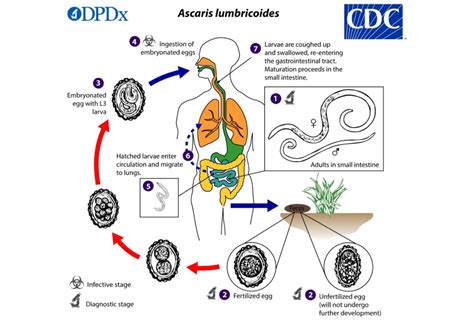 Youve Got Worms Common Intestinal Parasites