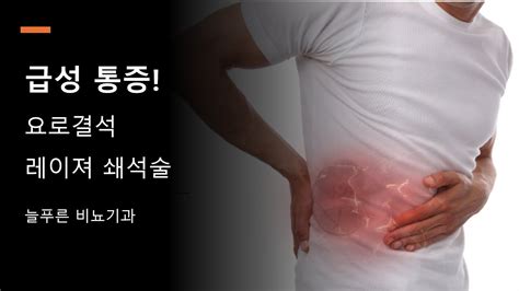 급성 통증 요로결석 시술 영상 Youtube