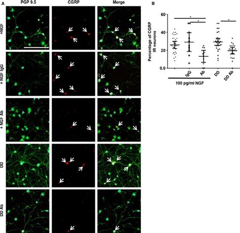Calcitonin Gene Related Peptide CGRP Expression In Mouse Dorsal Root