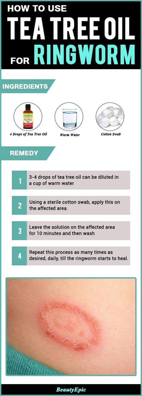 How To Apply Tea Tree Oil For Ringworm