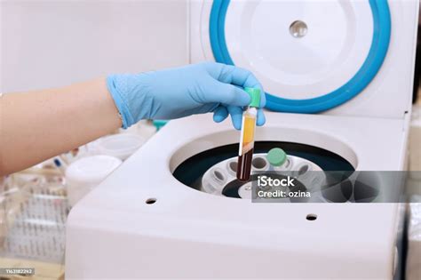 Prp를 위한 손에 혈장과 의료 튜브 플라즈마 리프팅을 위한 의료 원심 분리기에서 추출 Platelet Rich Plasma에