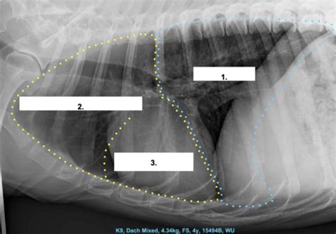 Block 4 Radiology Flashcards Quizlet