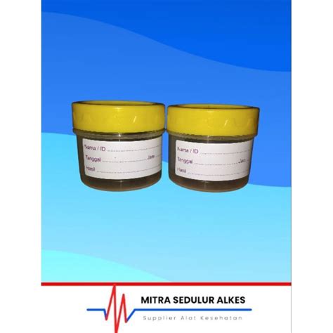 Jual Pot Sputum Pot Dahak Pot Urine Container 60ml Shopee Indonesia