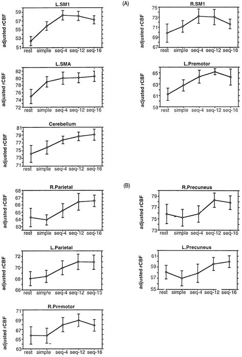 The Mean Adjusted Rcbf And Standard Deviations In Cortical Regions From Download Scientific