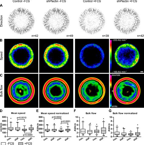 Keratin Filament Dynamics Are Affected By Plectin Deficiency In The