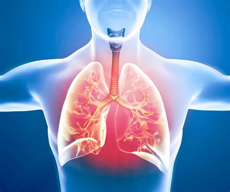 Human Anatomy Problems With The Respiratory System Severely Damaged