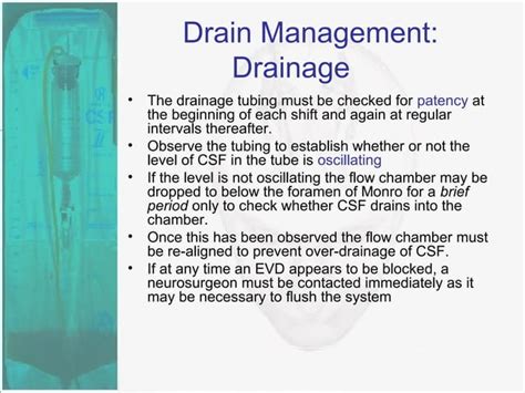 External Ventricular Drain Ppt