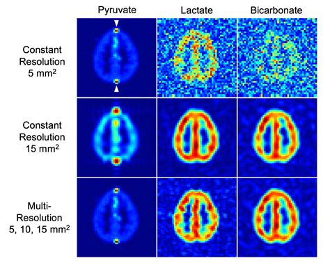Jasmine Y Graham 1 2 Peder E Z Larson 2 Daniel B Vigneron 2 And Jeremy W Gordon 2