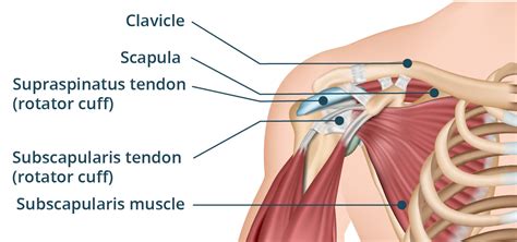 Rotator Cuff Tear