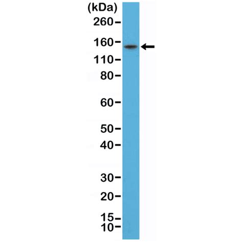 Thyroid Peroxidase