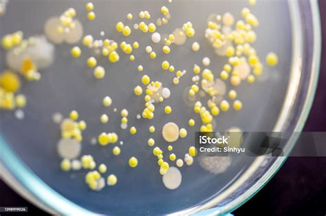 微生物学研究室での教育のための土壌サンプルから寒天プレート上に成長する細菌とカビの特性と異なる形状のコロニーの背景 アイデンティティーの