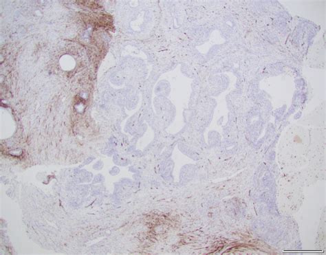 March 28 2022 Pathology