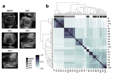 Medical Imaging Dataset Structure Download Scientific Diagram