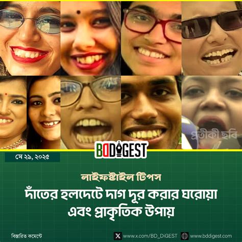 Bddigest দাঁতের হলদেটে দাগ দূর করার ঘরোয়া ও প্রাকৃতিক উপায় Bddigest বিডিডাইজেস্ট Facebook