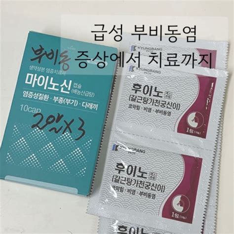 독감 후 급성 부비동염 전염될까증상 치료 치통 약국약 네이버 블로그