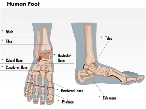 92977340 Style Medical 1 Musculoskeletal 1 Piece Powerpoint