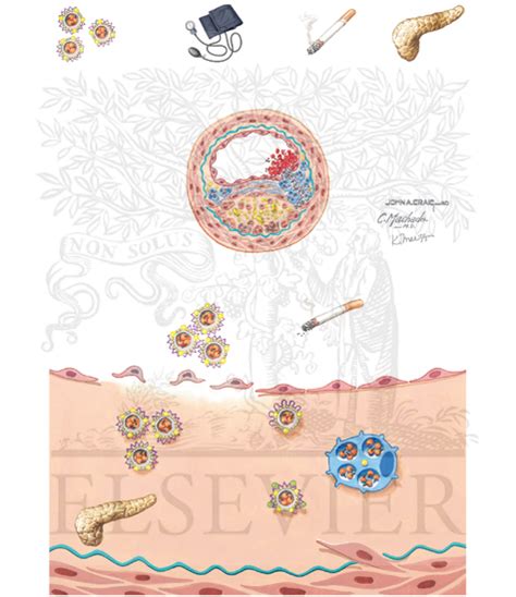 Atherosclerosis Risk Factors