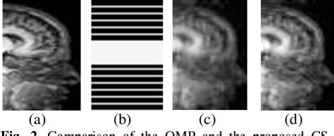 Figure 2 From A Novel Compressive Sampling Mri Method Using Variable