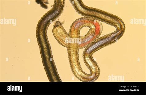 Roundworm Microscope Stock Videos And Footage Hd And 4k Video Clips Alamy