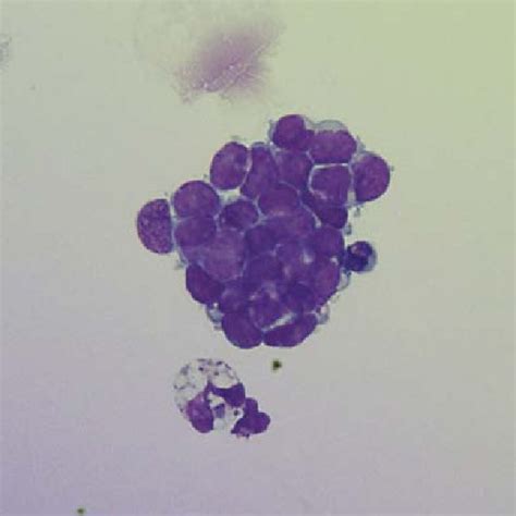 Right The Similarity In Location Between The Phlycten Superficial Download Scientific