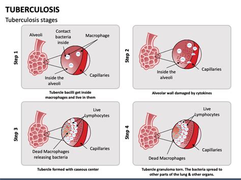 Tuberculosis Ppt Background Free Power Point Template Ppt Template