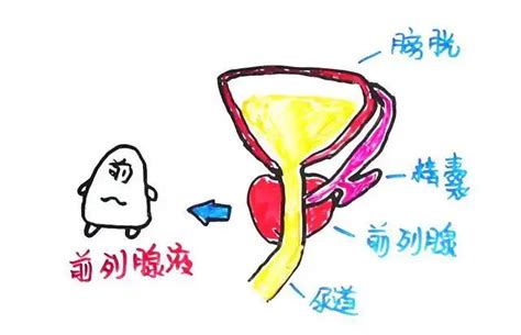 前列腺液检查，该怎么做？ 健康160