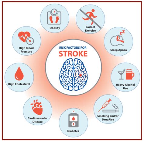 Data Science Analysis Of Stroke Prediction Exploratio Journal