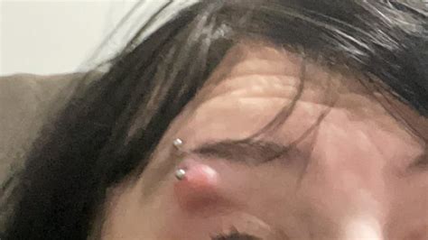 Hard Lump Under Piercing R Piercingadvice