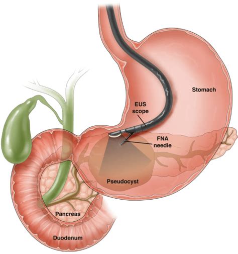 Ercp Specialist In Nashik Ercp Procedure Dr Husain Bohari