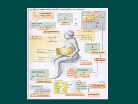 14disordersofendocrinesystem Signs And Symptoms Ppt