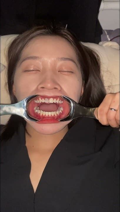 美女mm小姐姐口腔检查展示自己口腔情况牙齿喉咙扁桃体欣赏了解更多507871282 Youtube