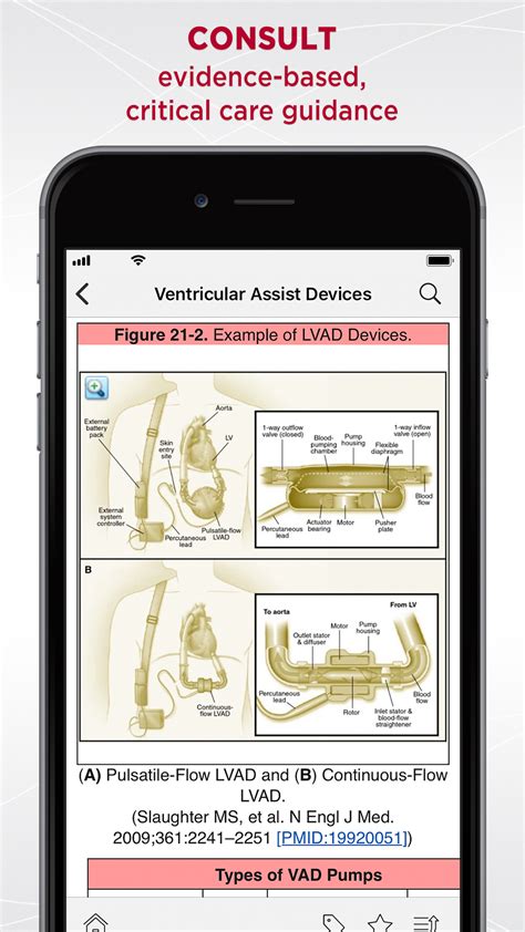 Iphone 용 Pocket Icu 다운로드