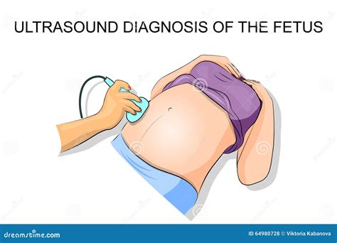 Ultrasound Diagnosis Of The Fetus Vector Illustration Cartoondealer