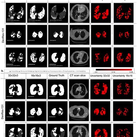 The Multi Classification Results Of Six Different Patients Of The Download Scientific Diagram
