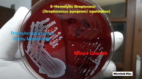 Beta Hemolysis Staphylococcus Aureus