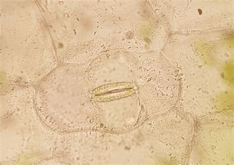 World Under Microscope Collection Opensea