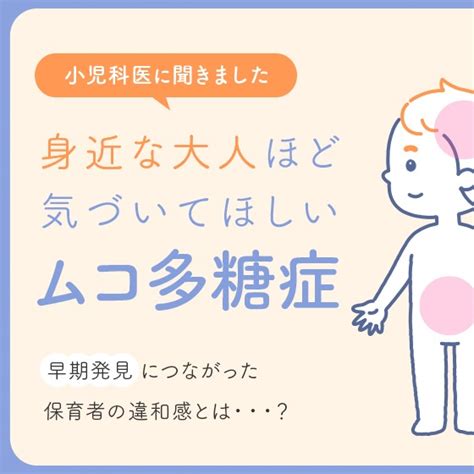 販売 ムコ多糖