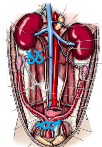 Female Reproductive Surgery Flashcards Quizlet