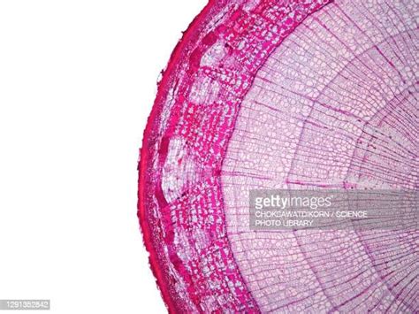 Micrograph Xylem Phloem Photos And Premium High Res Pictures Getty Images