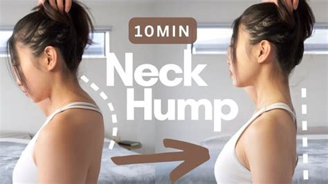 10min Fix Neck Hump And Forward Head Correct Posture Best Neck