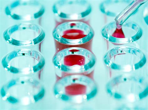 Peritonsillar Abscess Causes Symptoms And Treatment